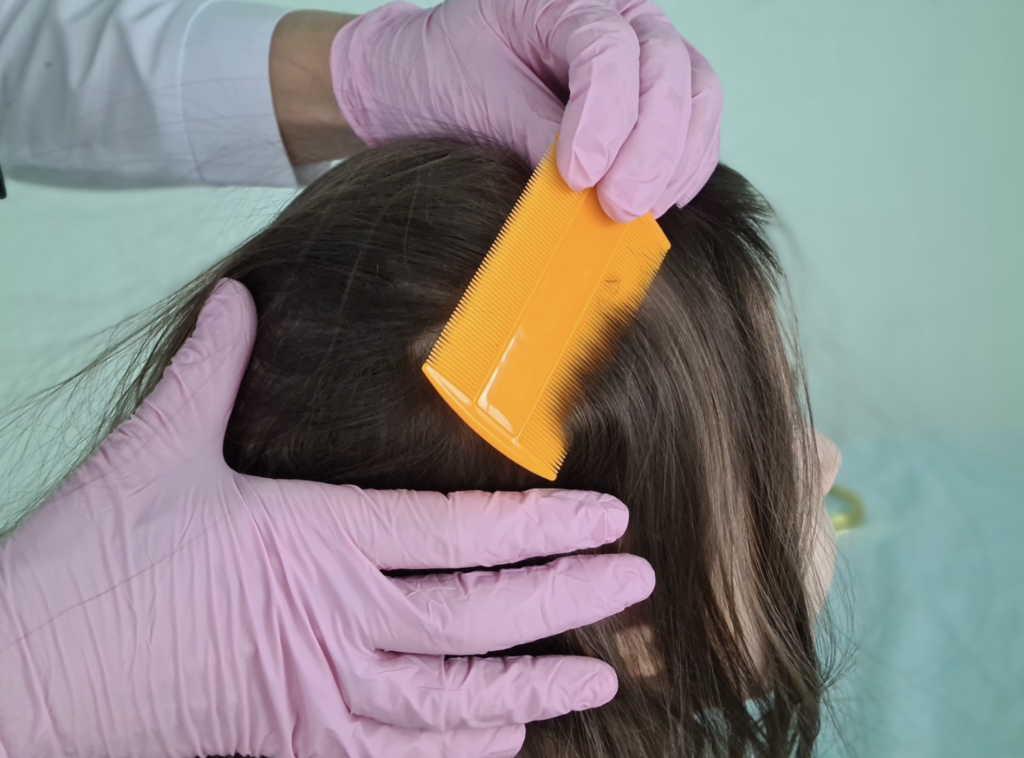 Can I Catch Head Lice More Than Once? - Lice Free NY
